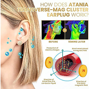 Dorina Earacupressure Magnetherapy Detoxi Earrings - Dorina Earrings, No Pierced Lymphvity Magnetic Therapy Acupressure Earrings for Women (4 pairs)