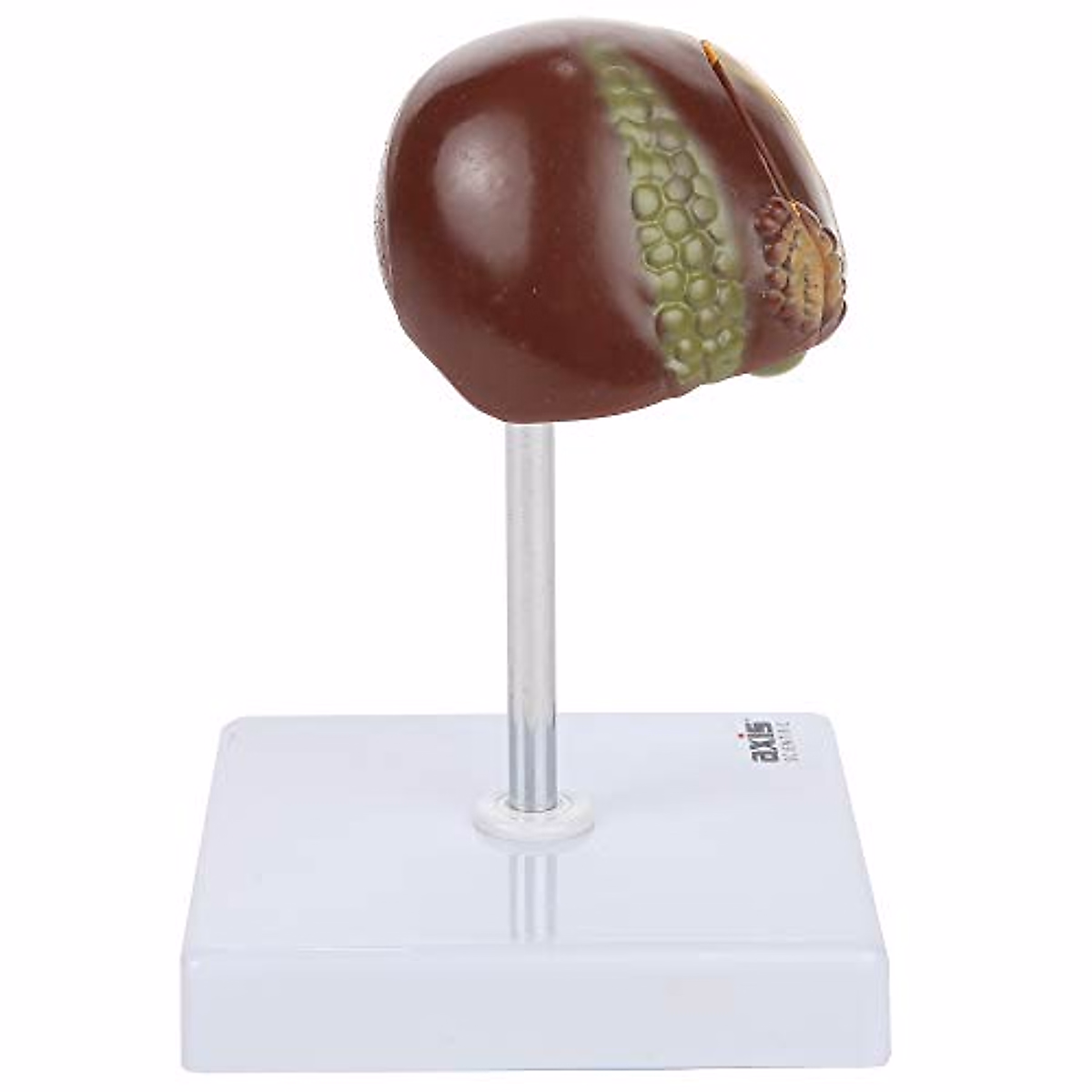 Axis Scientific Anatomy Model of Diseased Liver | Model is 1/3 Life-Size and Divides in 2 Parts | Shows 6 Liver Diseases and Abnormalities | Comes on a White Base