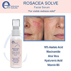 E70 Rosacea Solve Set - Includes Rosacea Cream, Serum and Moisturizing Face Wash - Combined Beneficial Ingredients such as Aloe Vera, Hyaluronic Acid, Niacinamide Coconut Oil, Cucumber, Wheat, Fruit Extracts, Licorice, Azelaic Acid 10% Chamomile Extracts