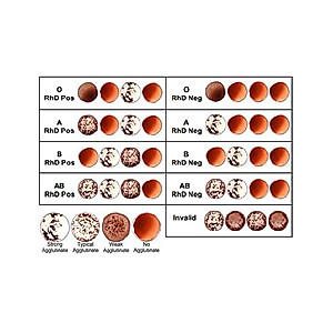 Eldoncard Blood Typing Kit, 3 Test Pack, Know Your Blood Type, Accurate Instant Home Testing, Determine A, O, B, Rhs-D Negative & Positive Groups