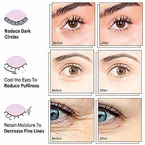 Award Winning Under Eye Mask (Pink, 48 Pairs) Reduce Dark Circles, Puffy Eyes, Undereye Bags, Wrinkles - Gel Under Eye Patches, Vegan Cruelty-Free Self Care by grace and stella