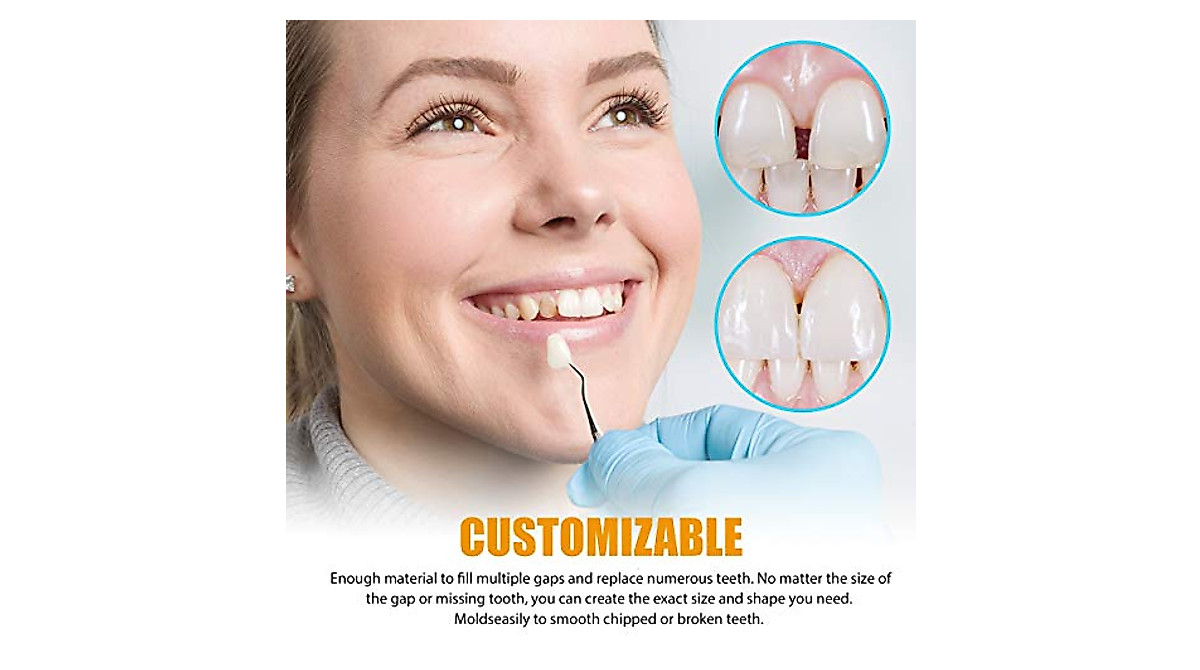 DIY Gap Eliminator Tooth Substitute - Smile Again Today