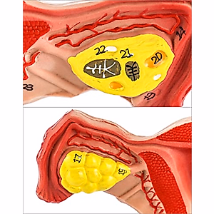 QWORK Human Female Uterus and Ovary Model, Female Genital Organ, Reproductive Organ Model, Uterine Medical Teaching Anatomical Gynecology Uterus and Ovary Model, Human Anatomy Replica