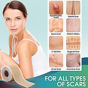 (1.6" x 150" Roll-3.8M) Professional Silicone Scar Sheets - Scars Removal Treatment - Reusable Silicone Scar Strips Type for Keloid, C-Section, Surgery, Burn, Acne et