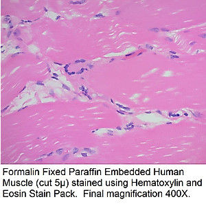Hematoxylin and Eosin Stain Pack, 1000ml