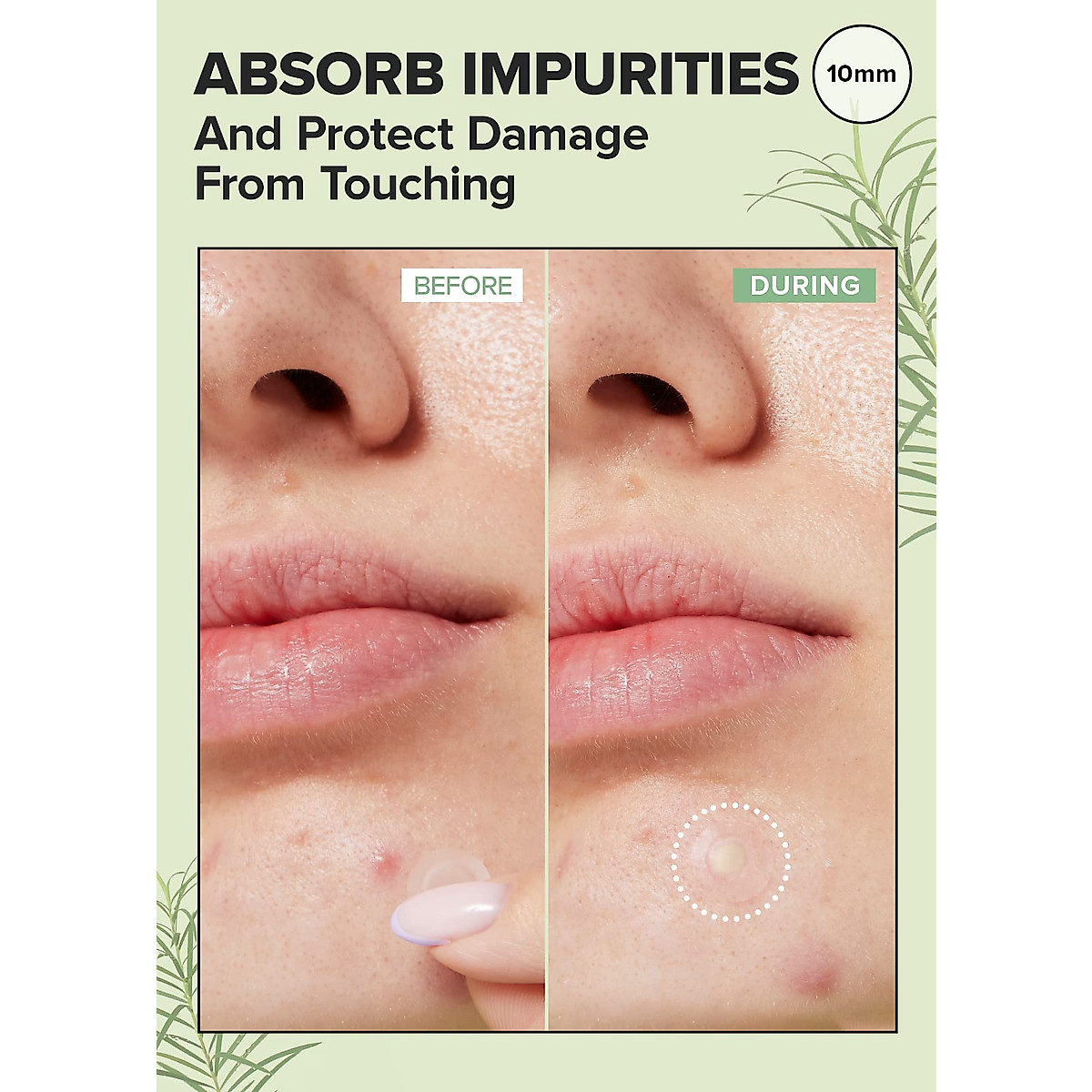 I DEW CARE Hydrocolloid Acne Pimple Patch - Timeout Blemish Original + Timeout Blemish Plus Bundle