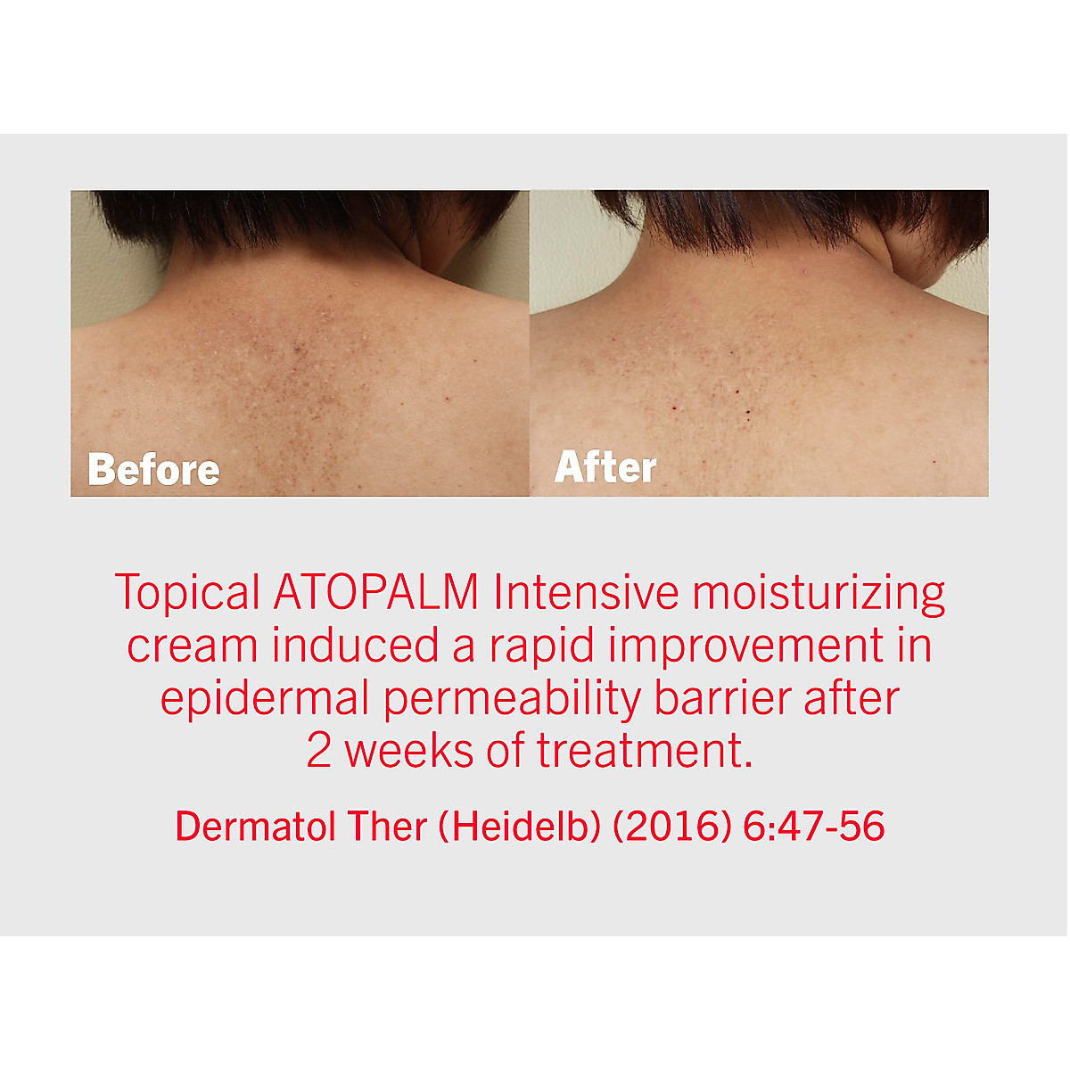 ATOPALM Intensive Moisturizing Cream for Dry & Sensitive Skin, Face Moisturizer, Replenishes Hydration, Paraben-Free, K-Beauty, skin barrier ceramide cream, 3.4 Fl Oz, 100ml (3.4 Fl Oz)