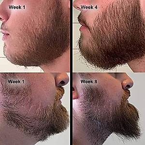 Beard Growth Kit - Hair Growth & Hair Serum - Beard Growth Oil and Beard Roller - Hair Growth for men - Stimulate Beard Growth with our Beard Serum and Growth Roller