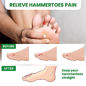 Bukihome Hammer Toe Straightener - 6 Pack Toe Splints - Soft Gel Hammer Toe Cushion - Realign Bent, Curled, Crooked, Claw, Hammer Toes - Toe Corrector for Men and Women, Medium Size