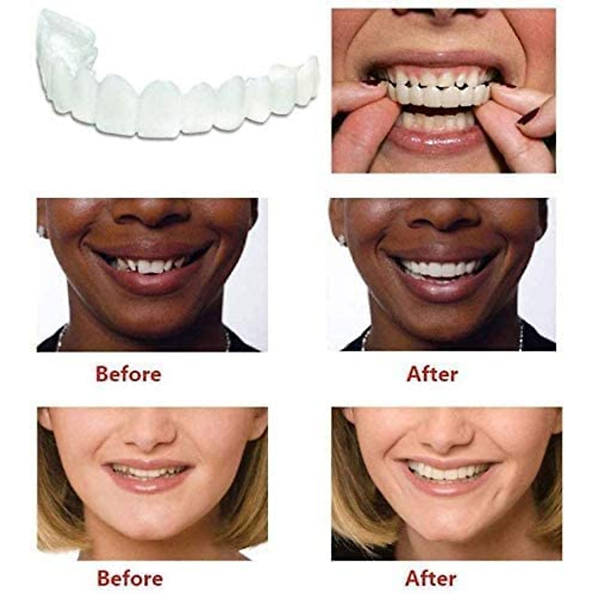 Dentures Fake Smile Teeth Moldable Customizable Temporary Top Teeth for Snap On Instant & Confidence Smile