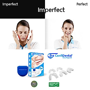 The ConfiDental - Pack of 5 Moldable Mouth Guard for Teeth Grinding Clenching Bruxism, Sport Athletic, Whitening Tray, Including 3 Regular and 2 Heavy Duty Guard (3 (lll) Regular 2 (II) Heavy Duty)