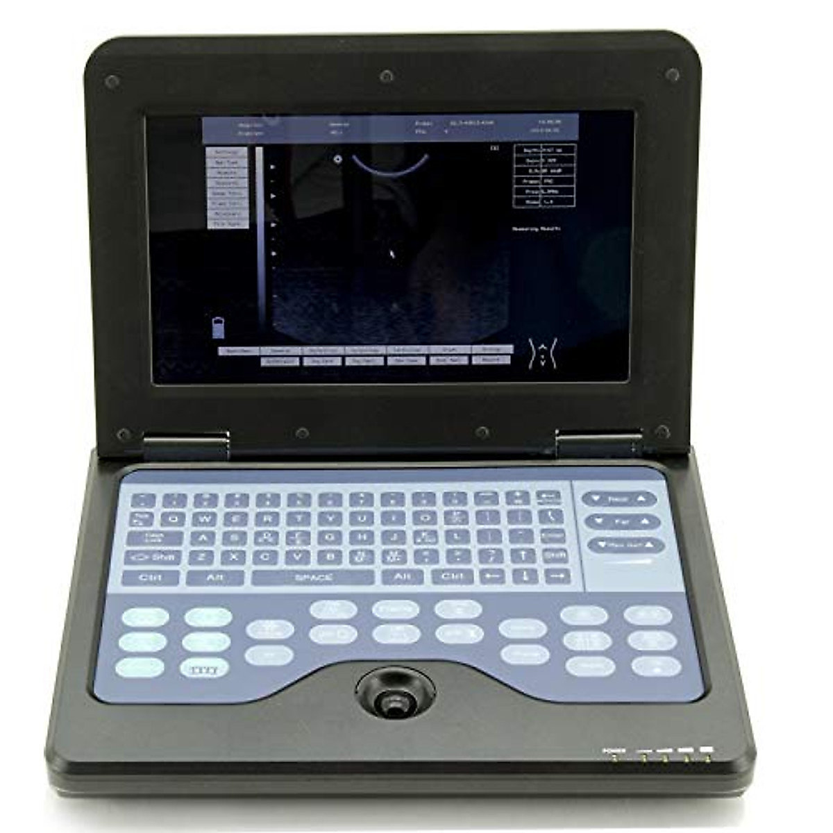 CONTEC Vet/Veterinary/Animal Portable B-Ultrasound Scanner with Tow Probes Convex and Rectal Probe for Cattle,Horse,Camel,Equine,Goat,Cow,Sheep and Pig