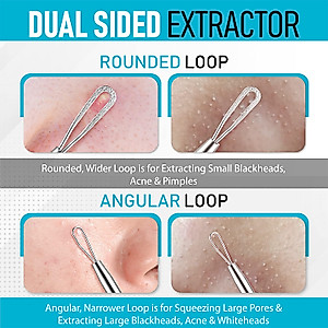 Hula Home Blackhead Remover Pimple Extractor Popper Tool Acne Comedone Blackhead, Blemish, Whitehead Popping, Zit Removing for Nose Face, 304 - Stainless Steel