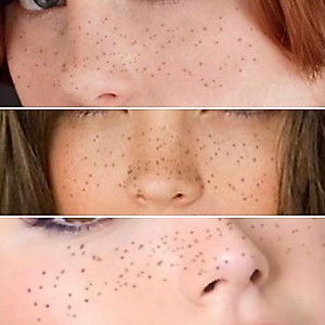 Frecklyz Waterproof Freckles - Pack of 6 Temporary Tattoo Face Stickers - Natural Looking Fake Tattoos Freckle Patch - Waterproof Makeup Accessories for Women