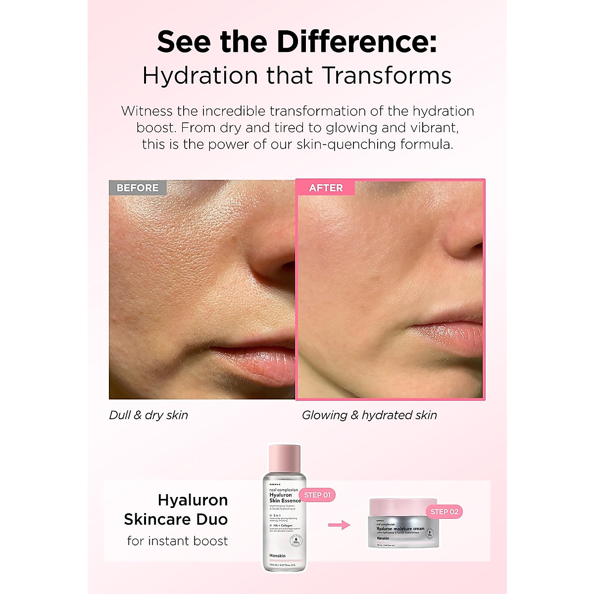 Hanskin Real Complexion Hyaluronic Skin Essence, Hydrating Toner for Dry, Dull, Sensitive Skin - Hyaluronic Acid Collagen Moisturizing Purifying Paraben-Free Korean Skincare for Face [5.07 fl. oz.]