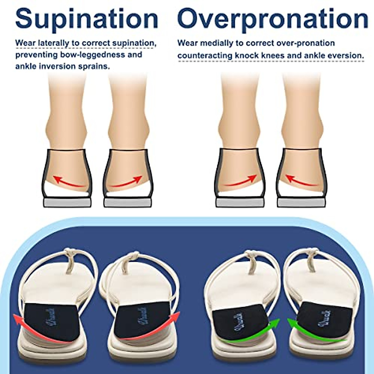 Urwalk 3 Layers Adjustable Supination & Over - Pronation Adhesive Corrective Gel Shoe Inserts, Medial& Lateral Heel Wedge Lifts for