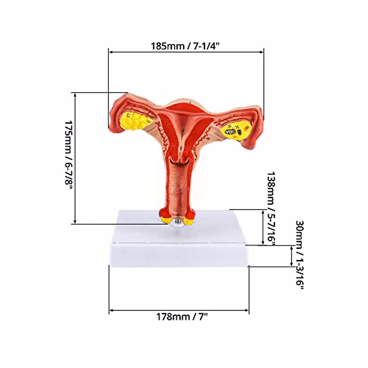 QWORK Human Female Uterus and Ovary Model, Female Genital Organ, Reproductive Organ Model, Uterine Medical Teaching Anatomical Gynecology Uterus and Ovary Model, Human Anatomy Replica