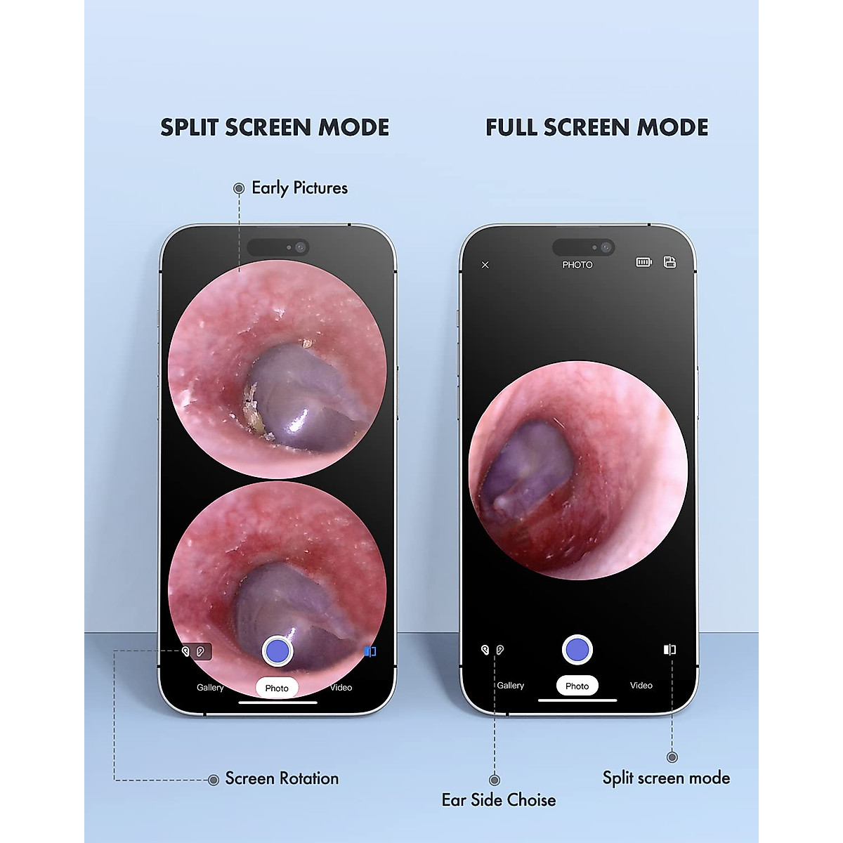 Anykit Wireless Otoscope Ear Camera with Dual View, 3.9mm 720PHD WiFi Ear Scope with Ear Wax Removal Tool for Kids and Adults & Pets, Compatible with Android and iPhone