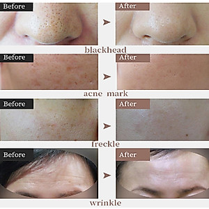 HBJH Led Face Mask Light Therapy, 7 led Light Therapy for Facial Skin Care - Blue & Red Light for facial oil Reduction and improve skin. (F-Masks-A)