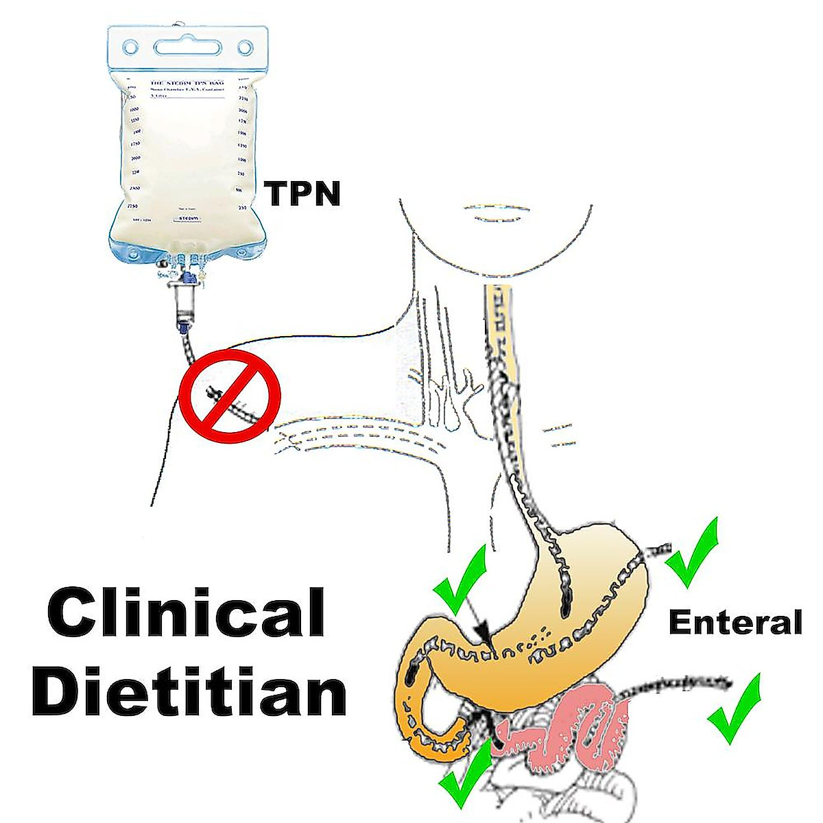 CafePress Clinical Dietitian Mug Ceramic Coffee Mug, Tea Cup 11 oz