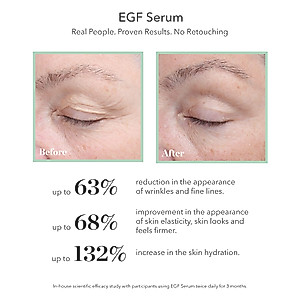 BIOEFFECT EGF Serum with Hyaluronic Acid and Barley Growth Factor, Best Rejuvenating Facial Treatment Fights Wrinkles, Hydrating, Firming, Anti-Aging Skincare for Face & Neck, Oil-Free