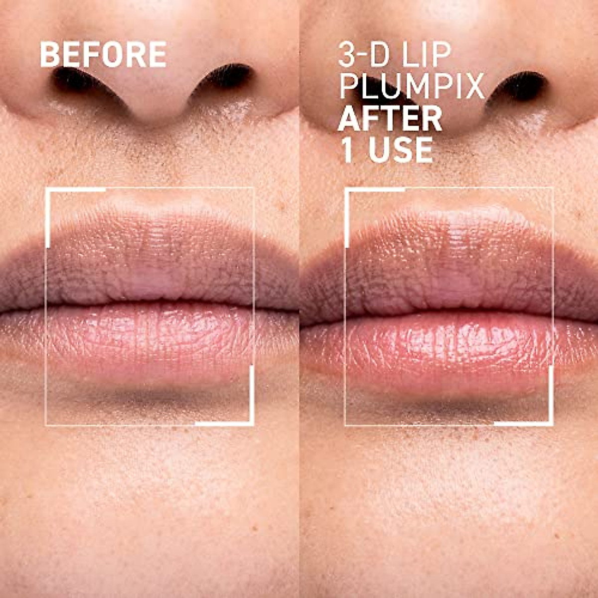 Dr. Brandt Skincare Needles No More 3-D Lip Plumpfix