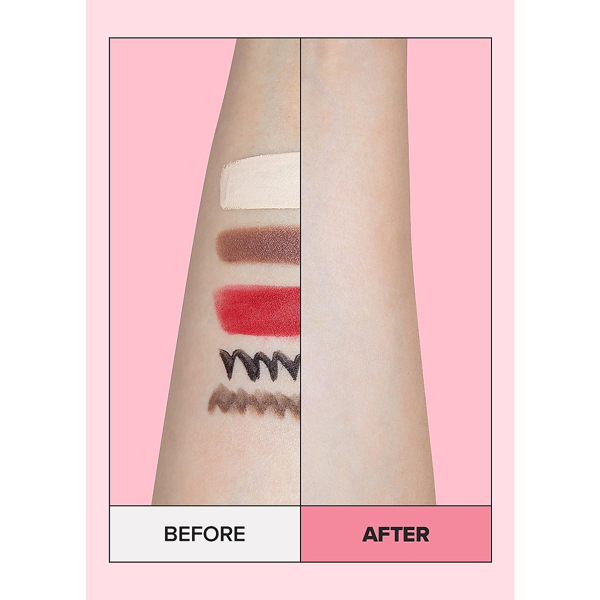 I DEW CARE Acne Facial Foam Cleanser - Namaste Kitten | Clarifying Heartleaf, Makeup Cleansing, Korean Skincare, Vegan, Cruelty-free, Paraben-free