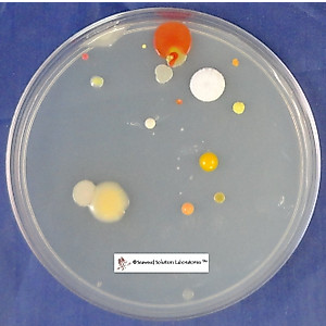 Nutrient Agar Kit, Includes Nutrient Agar Dehydrated, 10 Sterile Petri Dishes with Lids & 10 Sterile Cotton Swabs