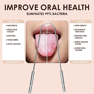 TruLife Tongue Scraper Tongue Cleaner Surgical Grade Stainless Steel (2 Pack), Reduce Bad Breath (Travel Cases Included), Metal Tongue Cleaner, Tongue Scraper for Fresher Breath & Easy to Use