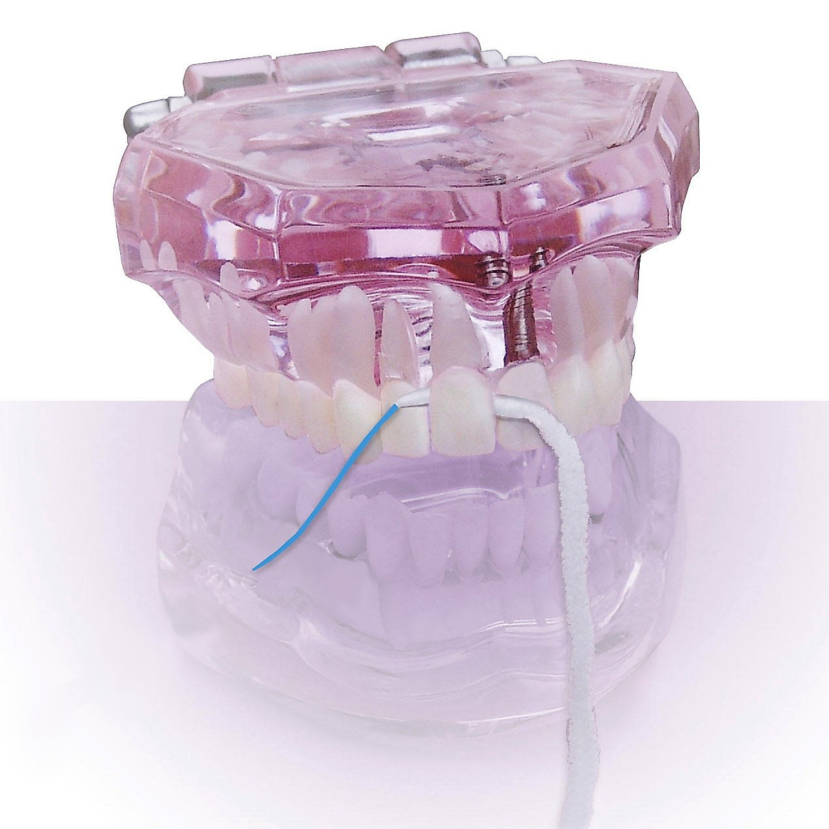 ProxySoft Periodontal Floss, 1 Pack - Dental Floss Threader, Braces Floss and Thick ProxyBrush for Daily Care of Periodontal Disease and Gum Health - Orthodontic Flossers for Braces and Teeth