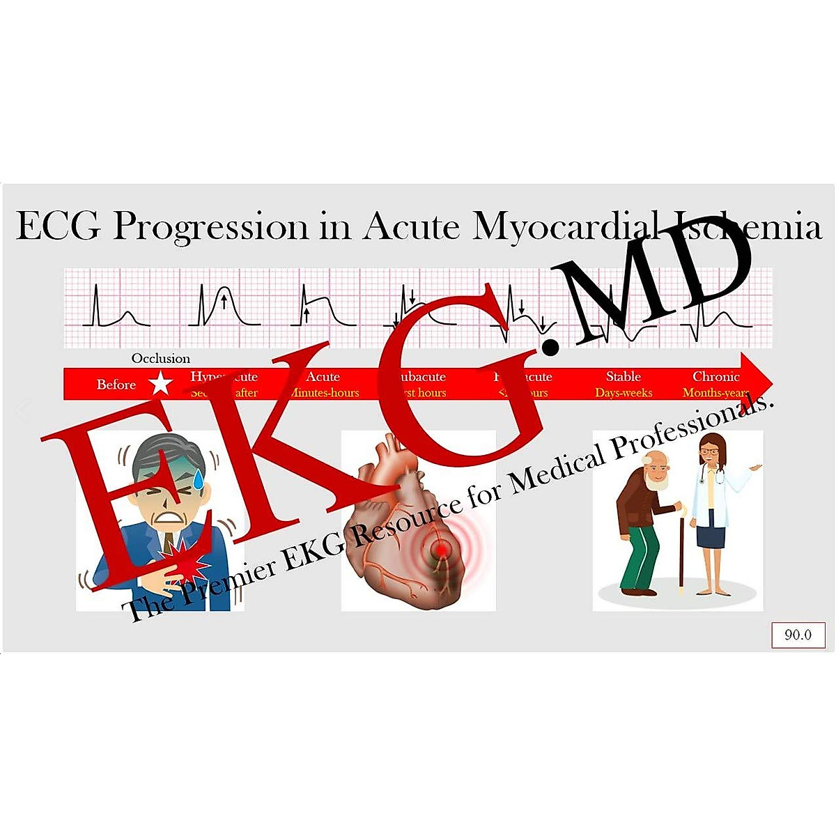 Ultimate EKG Breakdown - The EKG Guy