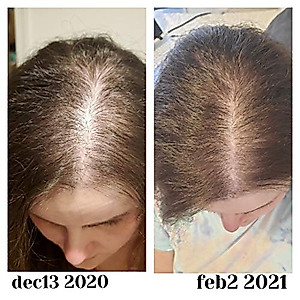 Baby Blues Postpartum Hair Loss Vitamins - Passion Fruit Gummies with Biotin, Collagen, & Folate