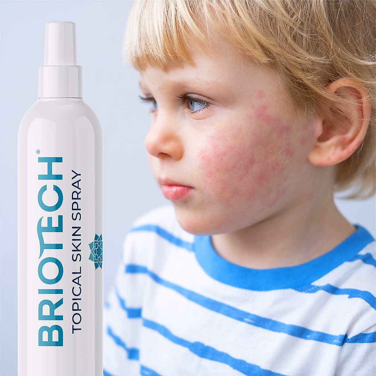 BRIOTECH Topical Skin Spray, Hypochlorous Acid Spray for Body & Face, Eyelid Cleanser, HOCl Facial Mist, Support Against Irritation and Redness, Stocking Stuffers, Packaging May Vary, 4 oz, 1 ct