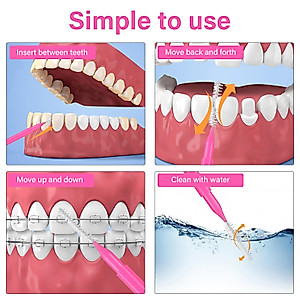 Healeved 100PCS Braces Brushes Interdental Brushes Braces Flossers Braces Brush for Cleaner Toothpick Dental Flossing Head Oral Flosser Dental Picks for Teeth Cleaning(5colors)