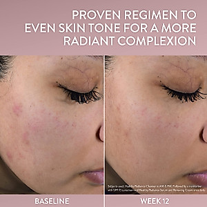 Cetaphil Face Wash, Healthy Radiance Gentle Exfoliating Cleanser, Visibly Reduces Look of Dark Spots and Hyperpigmentation, Designed for Sensitive Skin, Hypoallergenic, Fragrance Free, 4.2oz