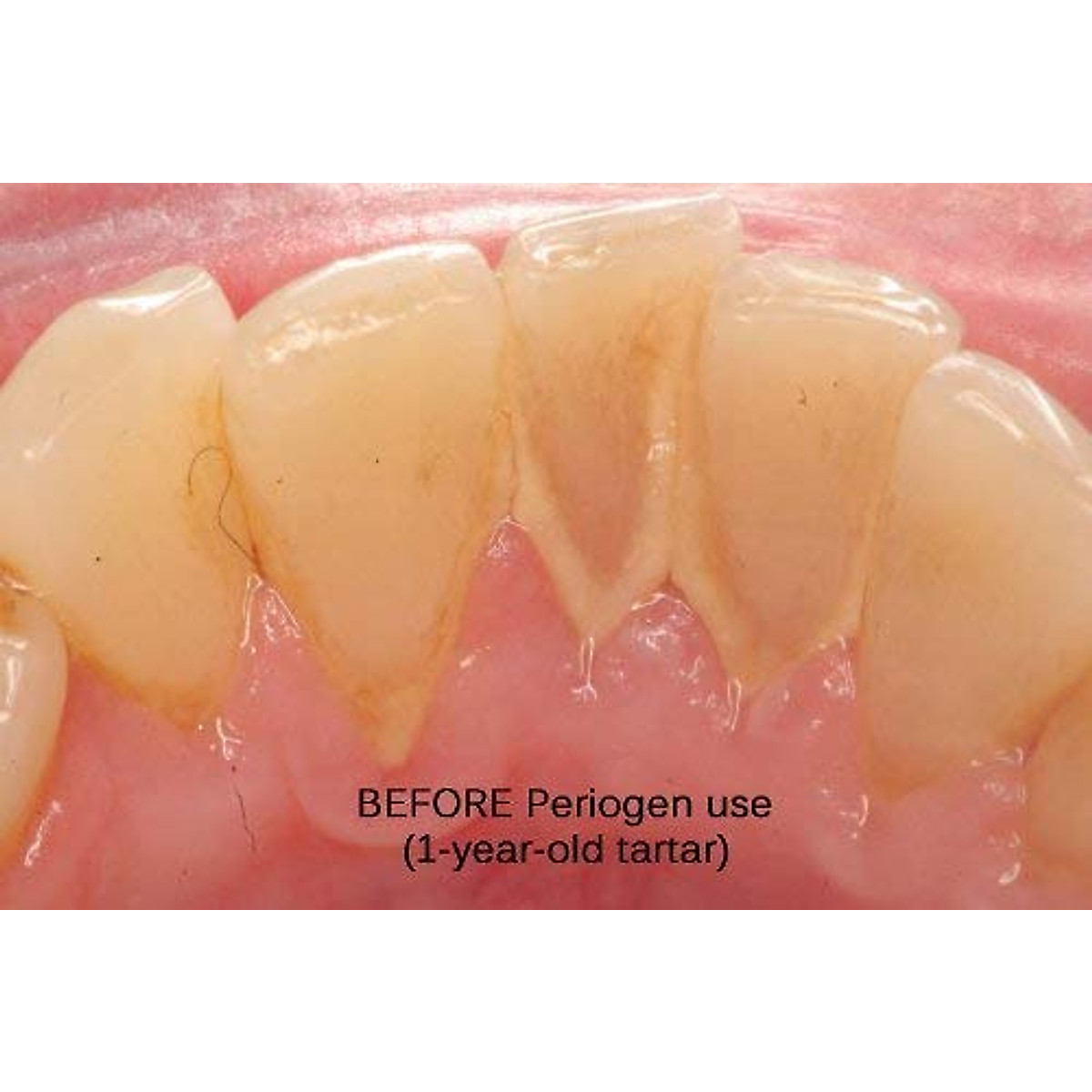 Periogen Complete Oral Health Rinse (3-PK)