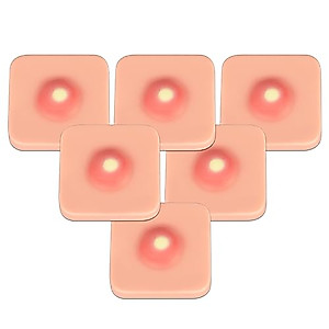 Ultrassist Abscess I&D Incision and Drainage Pad (6-Pack), Sebaceous Cyst Removal Trainer, Suture Practice Skin Pad for Medical Education