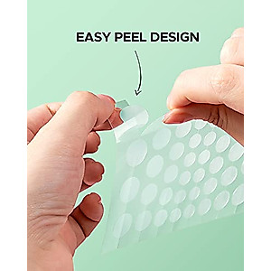 ZATKTK Acne Pimple Patch (180 Counts 4 Sizes), Invisible Hydrocolloid Acne Patch with Tea Tree Oil & Calendula Oil, Acne Spot Healing Patch Zit Patches for Face