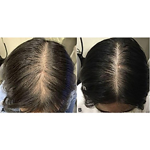 Organic Hair Solution-Hair Growth Pomade Grease with Peppermint-Mango Butter-Tea Tree - Argan- Jojoba seed- Avocado- Castor oil- For Scalp and Hair-For Stronger, Thicker Longer Hair-NOURISH & STRENGTH