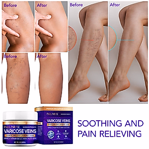 PAULINRISE Varicose Vein Cream for Legs - Improves Blood Circulation, Reduces Spider Veins and Heaviness, 2 Oz