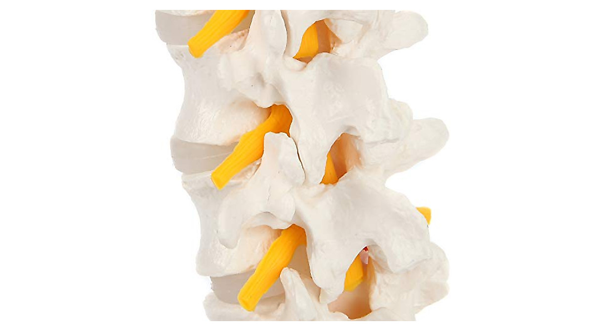 Lumbar Spine Anatomy Model with Nerves & Herniated Disc | Axis Scientific