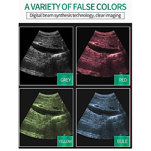 JeeKoudy Veterinary Ultrasound Scanner Machine, Handscan Vet Smart B-Ultrasound Machine Rechargeable Machine for Pig Horse Cow Pregnancy Animals Pets