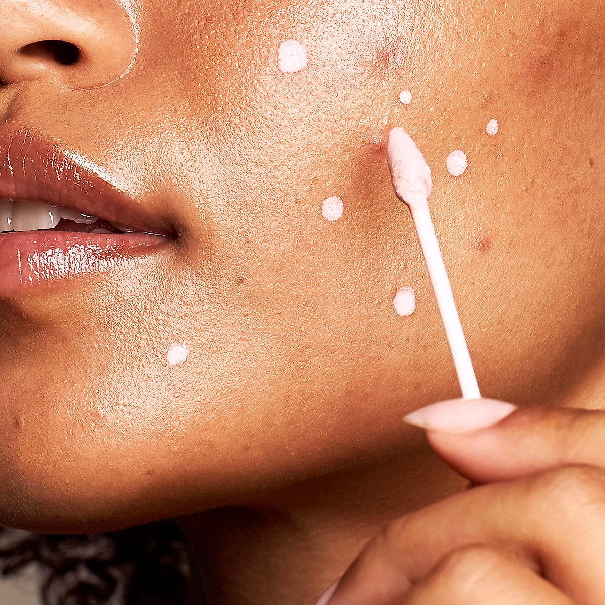 Kate Somerville EradiKate Acne Treatment - Clinically Formulated 10% Sulfur and BHA Spot Treatment – Clears Pimples, Cleans Pores and Prevents Breakouts, 1 Fl Oz