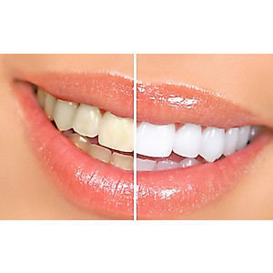 Pepsodent Complete Care Toothpaste Original Flavor 5.5 oz (Pack of 24)