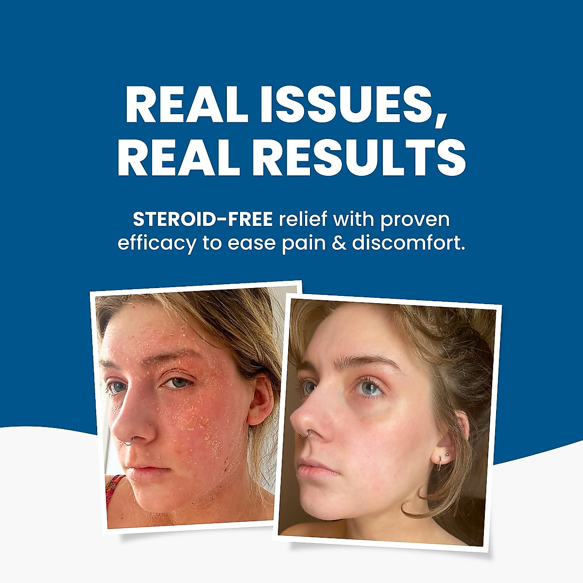 Grahams Natural C+ Eczema Relief Cream - Nourishes & Soothes Dermatitis, Inflammation, Redness Treatment for Irritated, Dry Skin - All Natural Ingredients with Manuka honey, Steroid-Free (1 x 1.76oz)