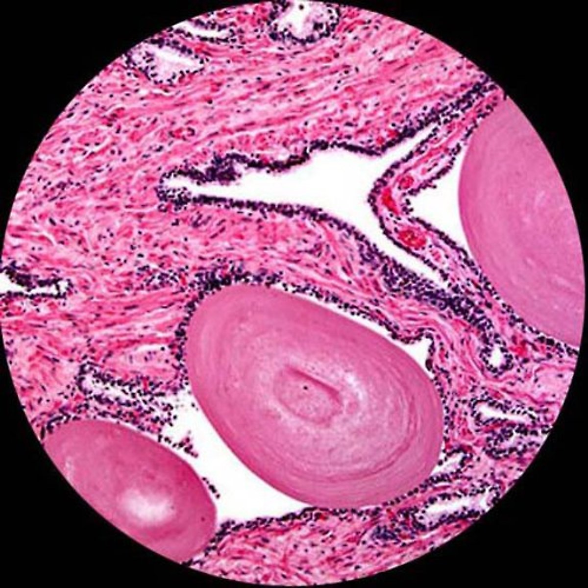 AmScope MU130 1.3MP USB2 Microscope Digital Camera + Editing & Measuring Software, Compatible with Windows XP/Vista/7/8 and Mac OS 10.6 & Up