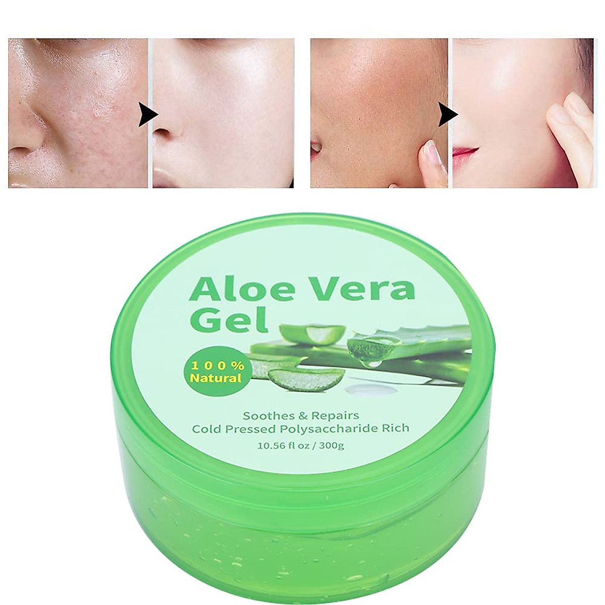 300g Gel Remove Pimples Shrink Pores After-Sun Repair Moisturizing Face Gel Skin Care, Prevent Skin Inflammation