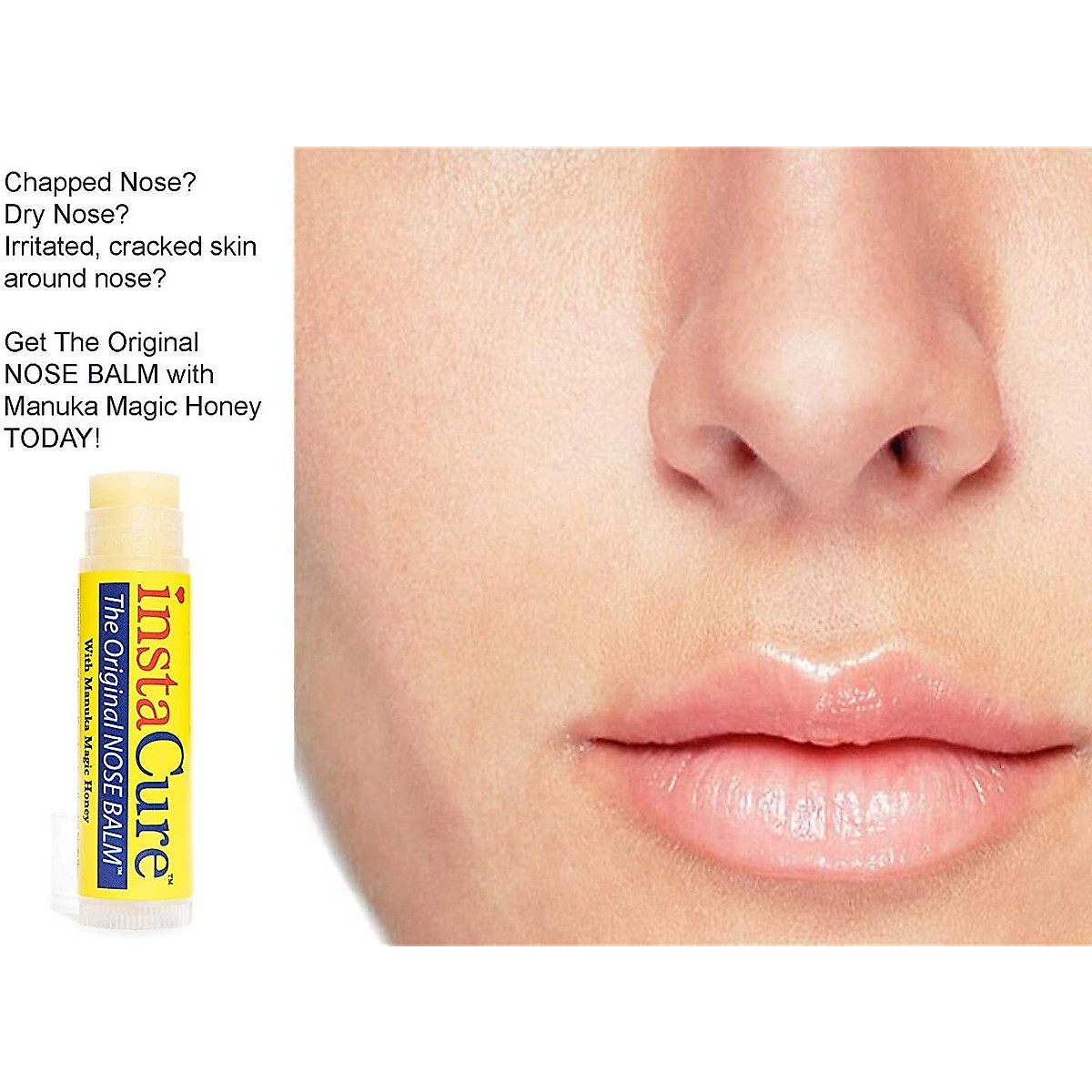 INSTACURE Original Nose Balm. Fast Relief for Cracked Dry & Sore Noses with Raw Manuka Honey Vitamin E Shea Butter Aloe Vera Oil. Heals Dog’s Dry Cracked Nose (1 Pack)