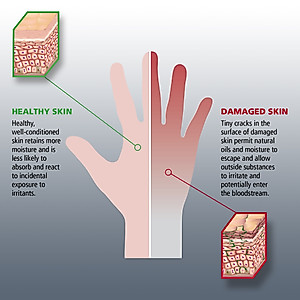 GOJO HAND MEDIC Professional Skin Conditioner, Fragrance Free, 2 fl oz Travel Size Squeeze Bottle (Pack of 12) - 8142-12