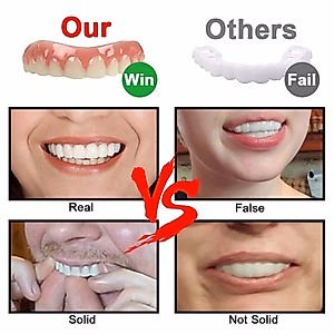 CHNLML Fake Teeth, Cosmetic Denture Veneers for Upper and Lower Jaw, Dental Veneers for Temporary Teeth Restoration, Nature and Comfortable, Protect Your Teeth - 2 Pcs